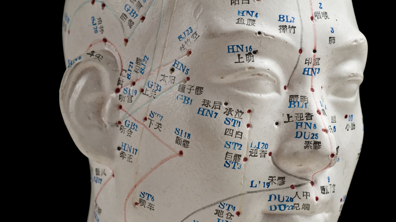 A New High-Tech Upgrade To Acupuncture Lets You See It’s Working In Re