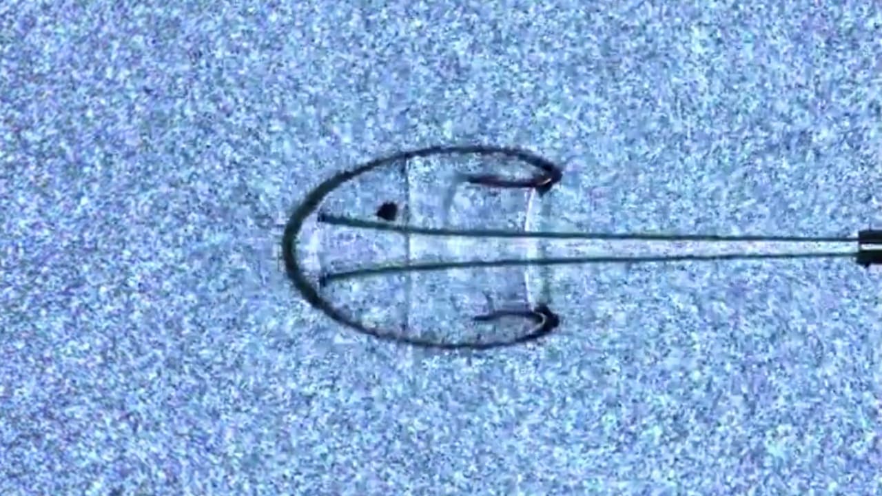 No More Needles: Get Your Future Drugs Via Jet Injection