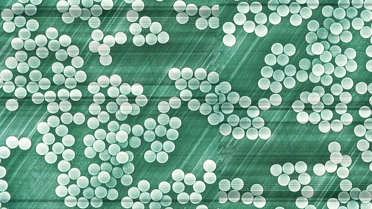 Say Goodbye To This Scourge Of The Great Lakes: Microbeads