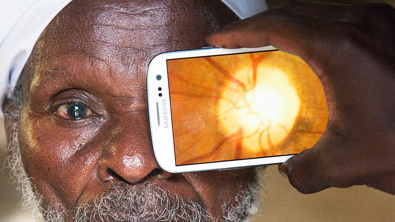 This Clever Device Turns Phones Into Sophisticated Eye Exam Machines