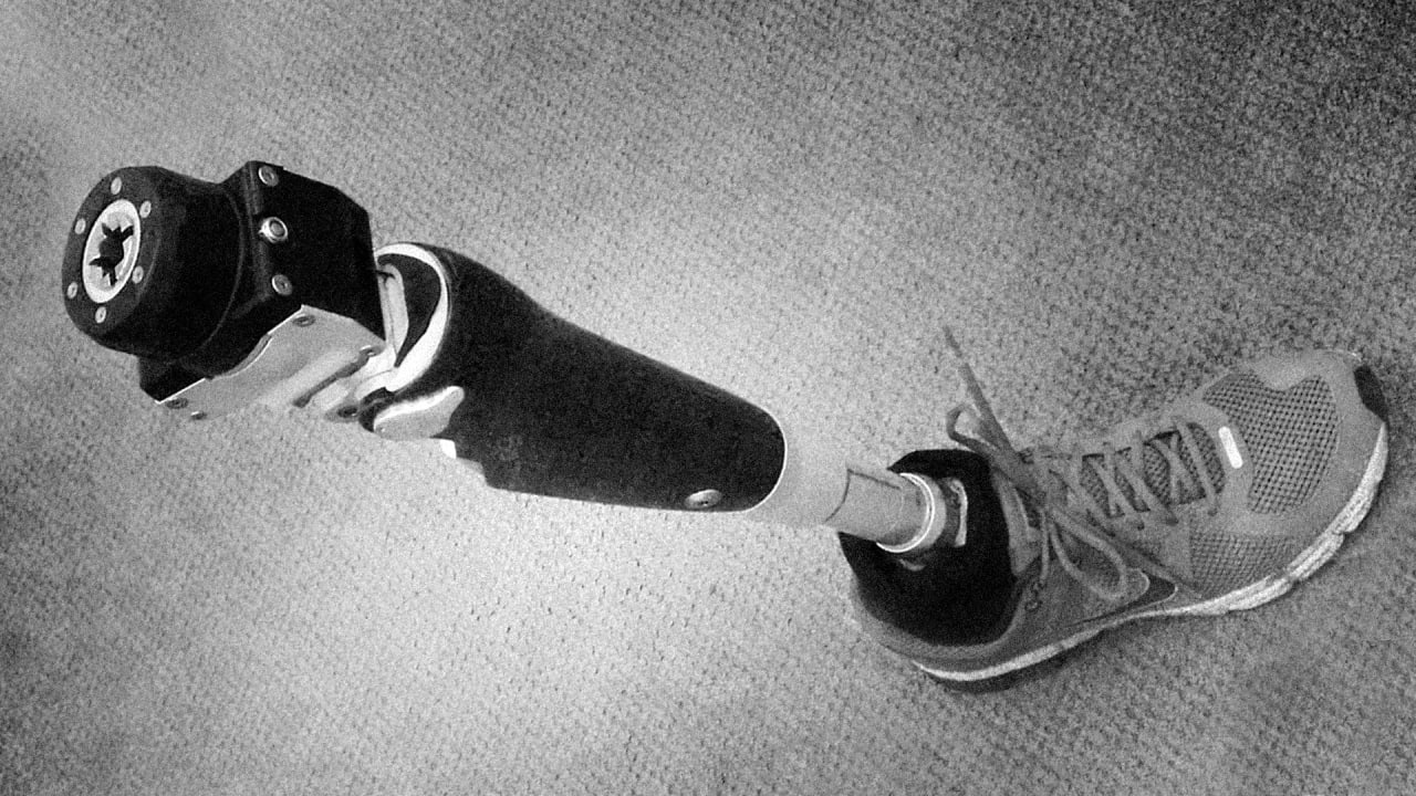 This Snap-On Prosthetic Leg Could Make Life Way More Comfortable For A