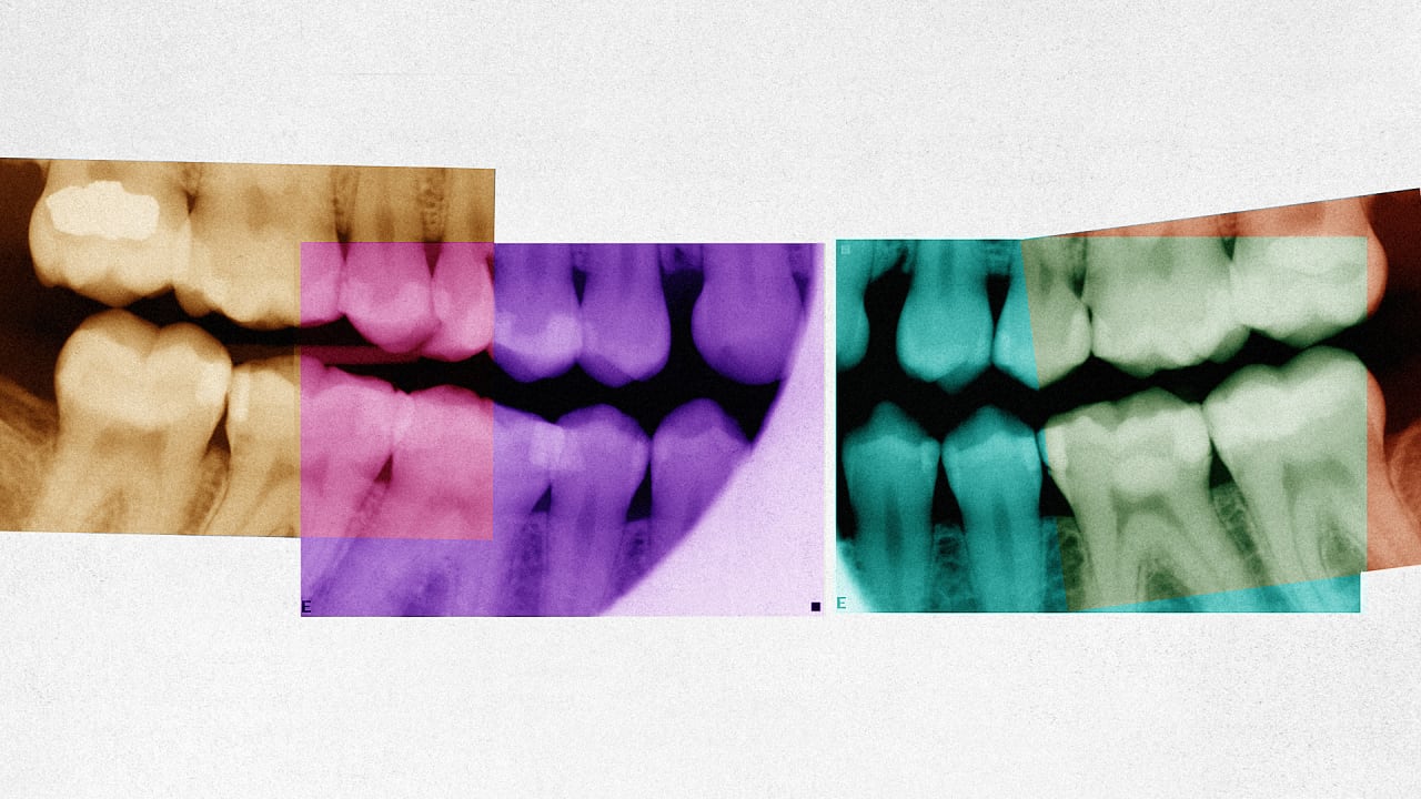 These Anti-Microbial Fake Teeth Will Wage War On Tooth Decay