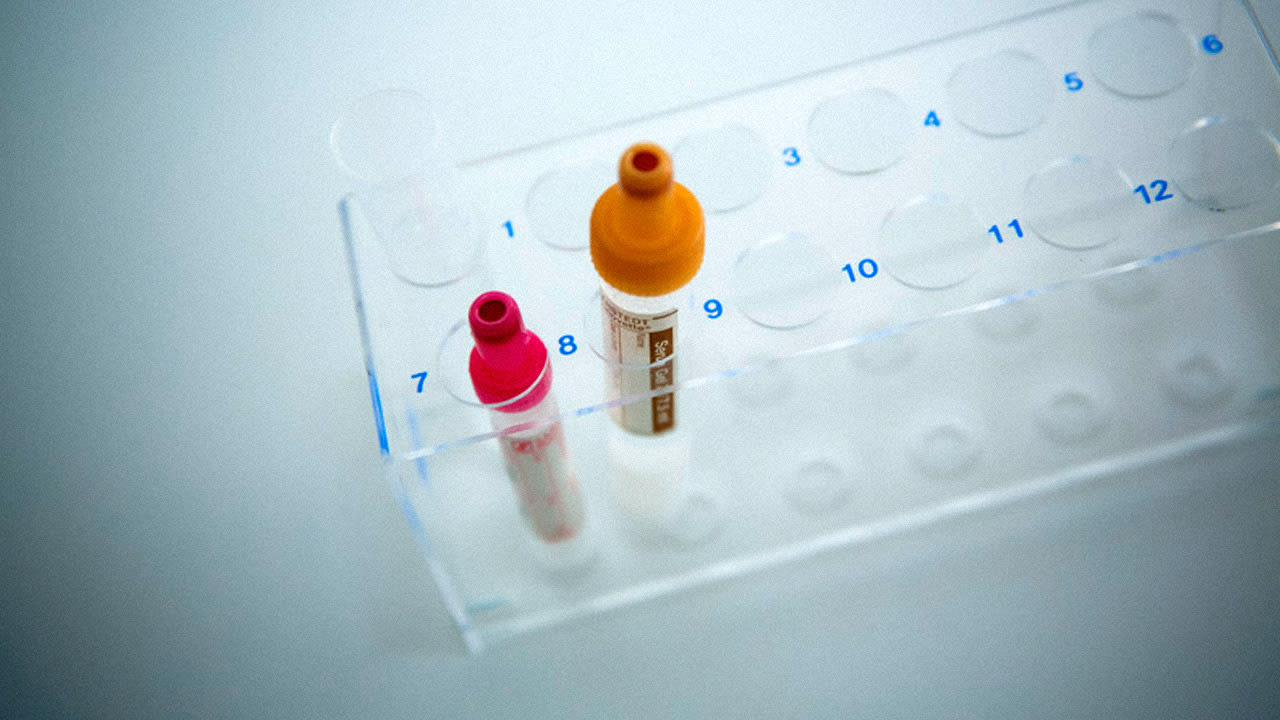 Researchers Who Reviewed Theranos’s Blood Tests Believe The Company’s