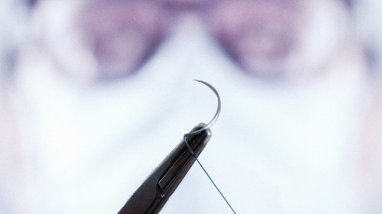 This Smart Surgical Thread Collects Data As Wounds Are Healing