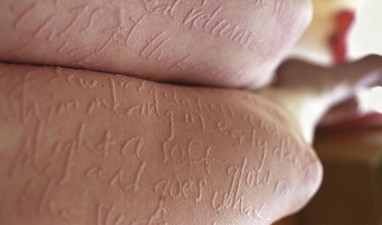 Artist Uses Her Own Skin As A Canvas, Turning A Disease Into Art