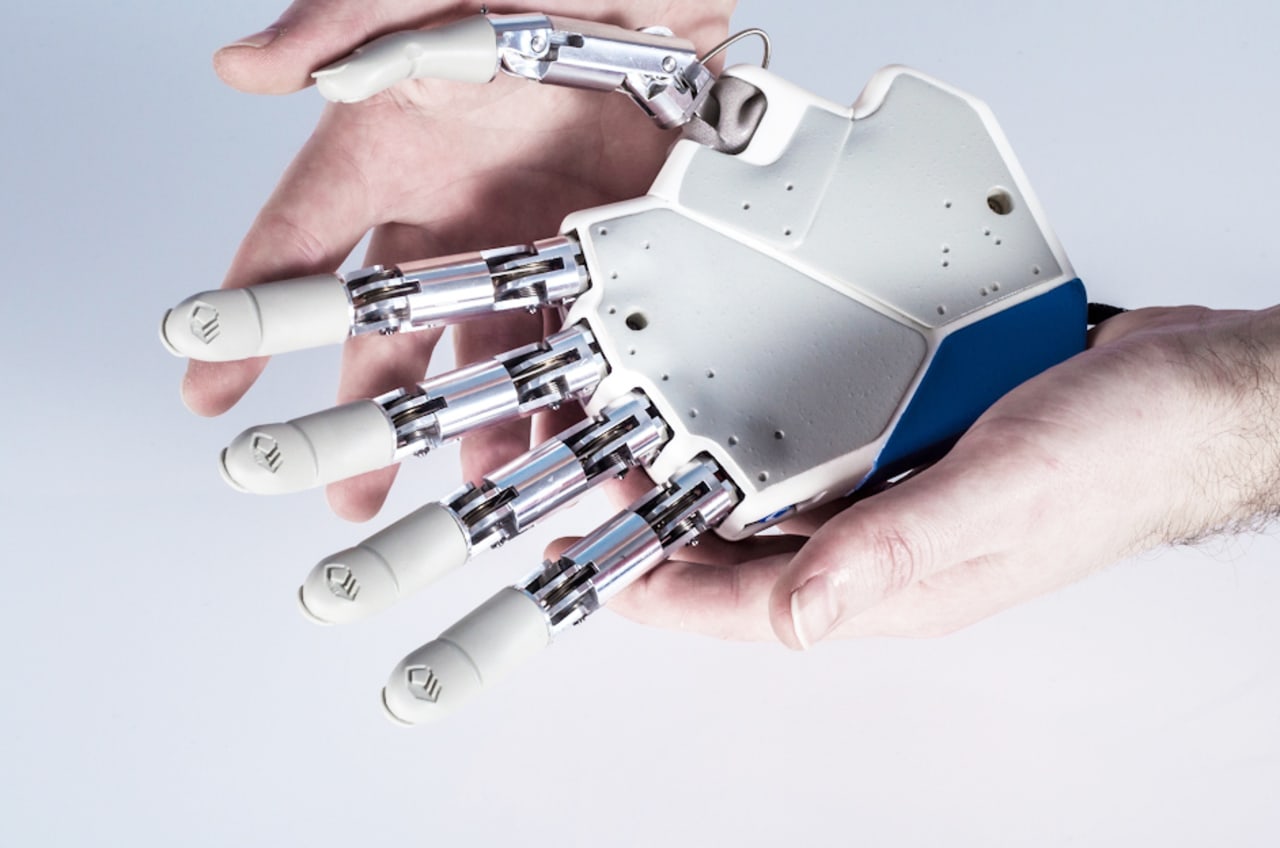 This Amazing Bionic Hand Can Actually Feel Someone’s Touch