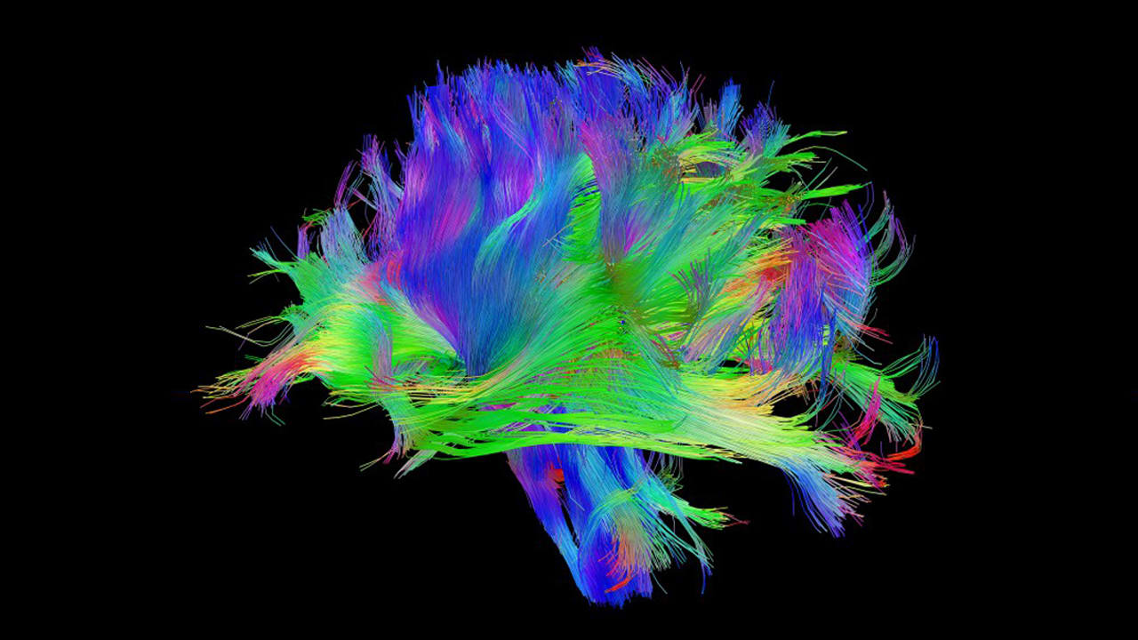 8 Mind-Blowing Images Of The Brain At Work