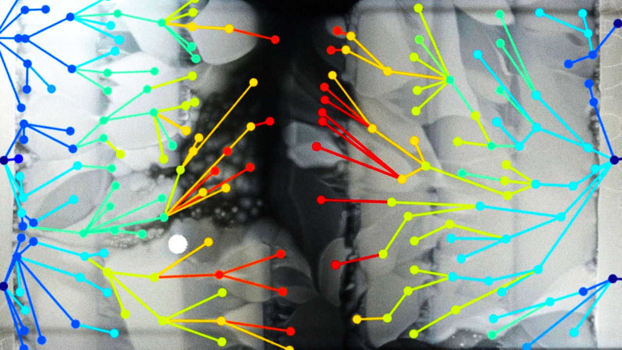 Watch How Quickly Bacteria Becomes Resistant To Drugs
