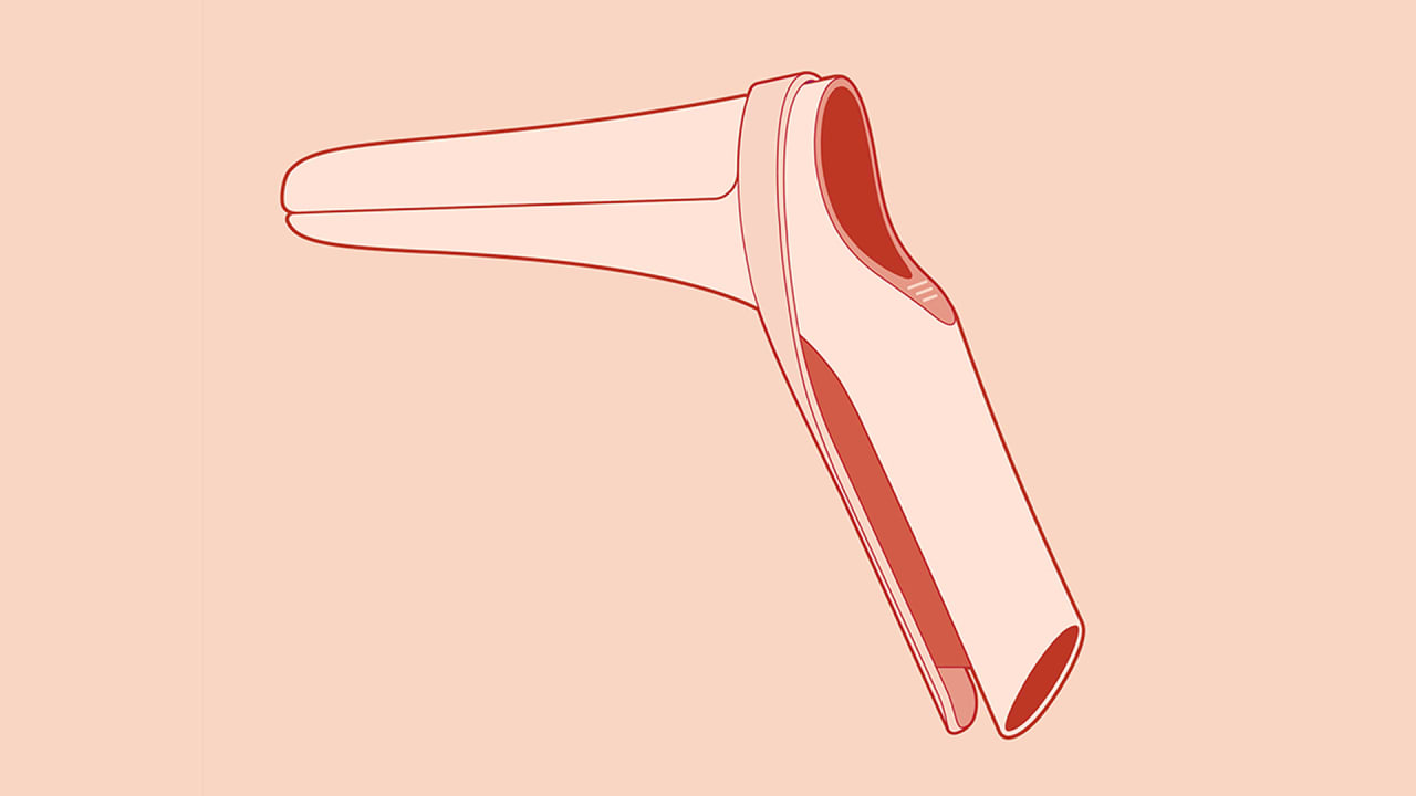 Frog Redesigns The Dreaded Gynecology Exam