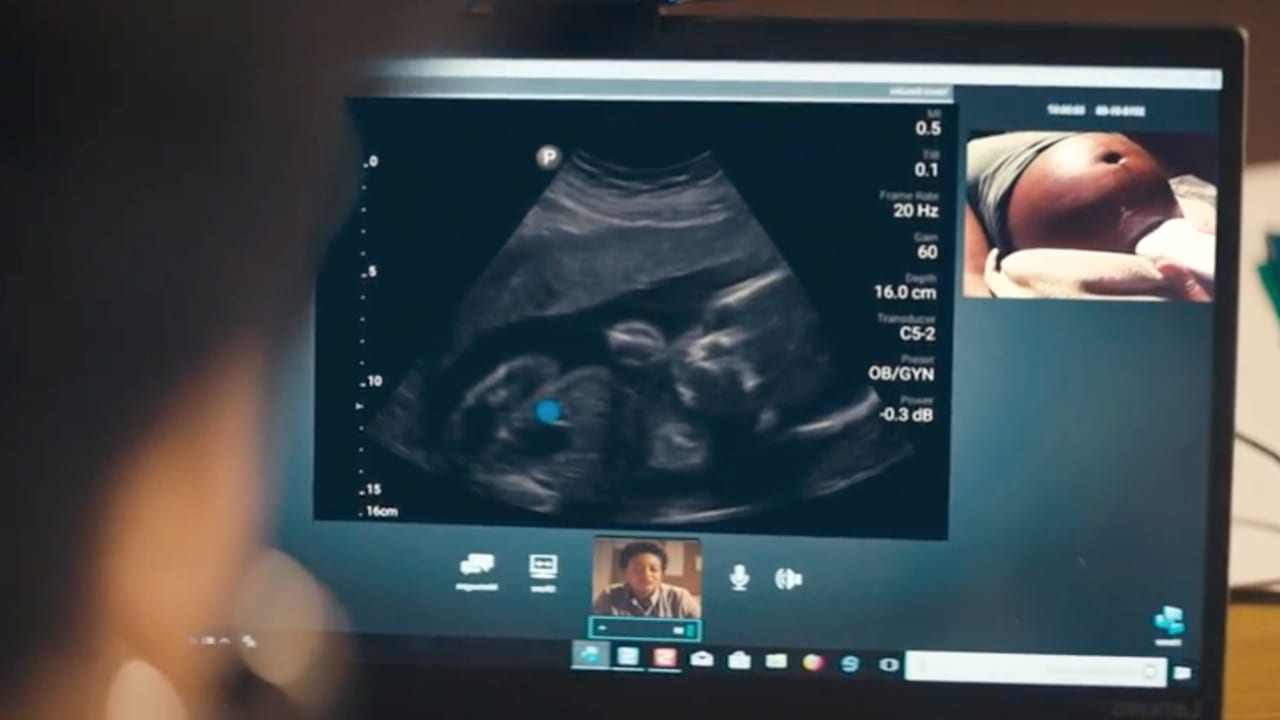Smartphone-compatible ultrasound machine streams images from remote lo
