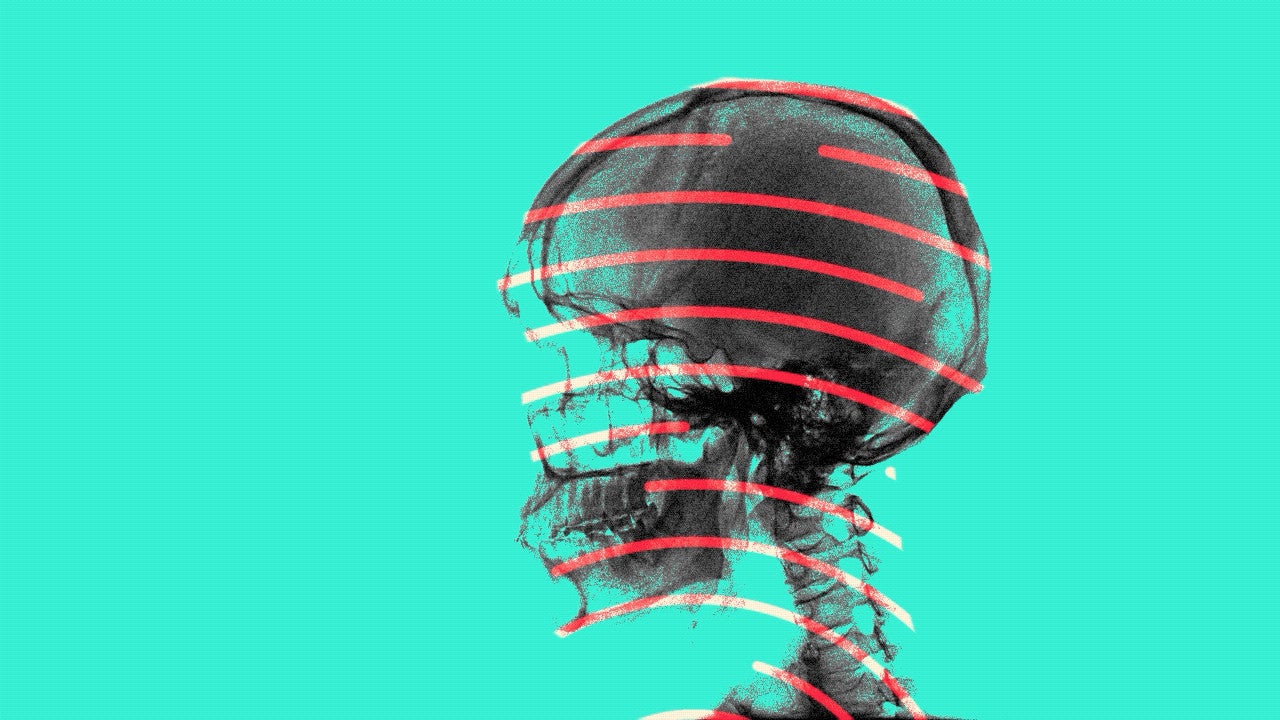 Is 5G Dangerous For Your Health 