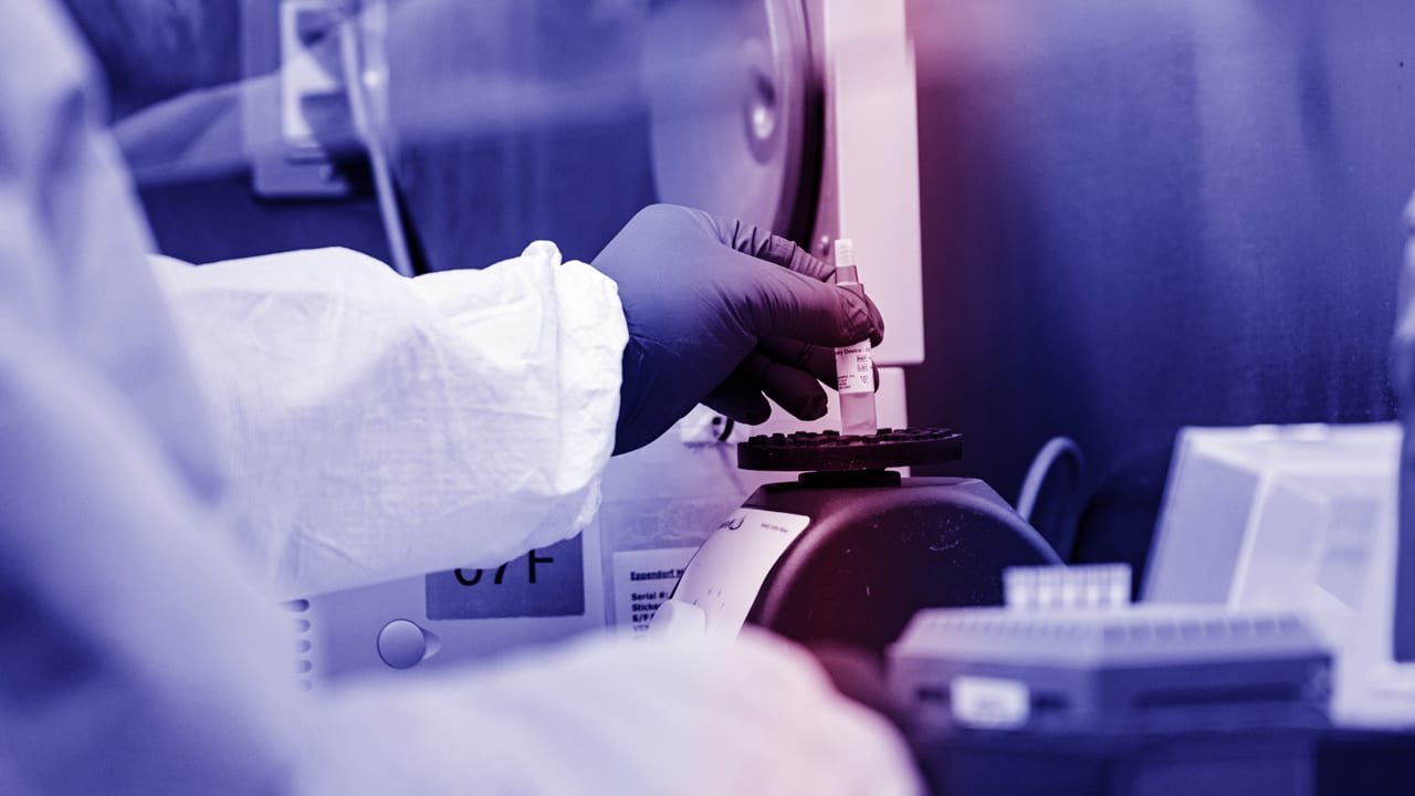 Gilead stock tanks after antiviral COVID-19 drug trial Gilead stock tanks after antiviral COVID-19 drug trial