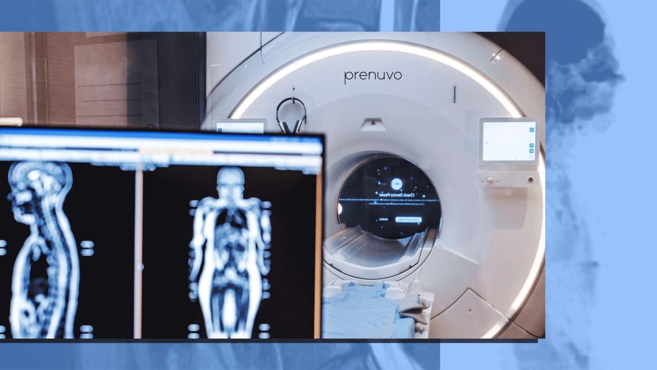 What is Prenuvo? How an MRI became a luxury status symbol | 15 Minu...