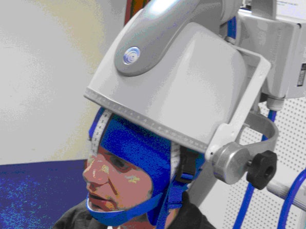 FDA Approves Magnetic Helmet For Treating Depression